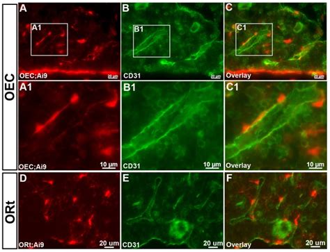 Immunostaining For The Endothelial Cell Marker Cd31 Revealed That Oec Download Scientific