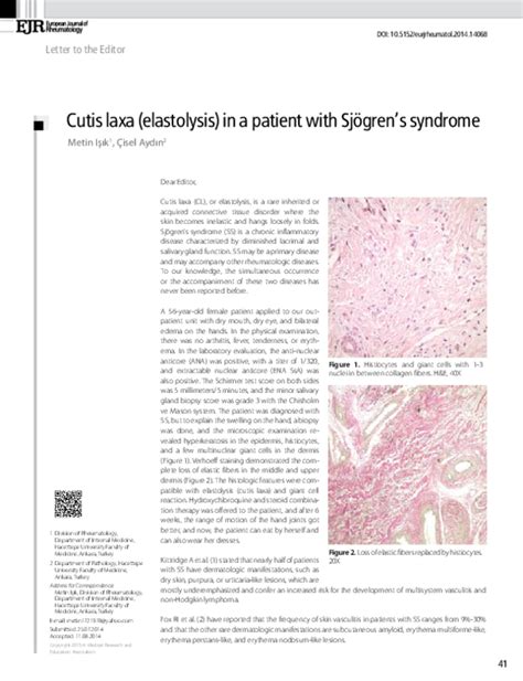 Pdf Cutis Laxa Elastolysis In A Patient With Sjögrens Syndrome