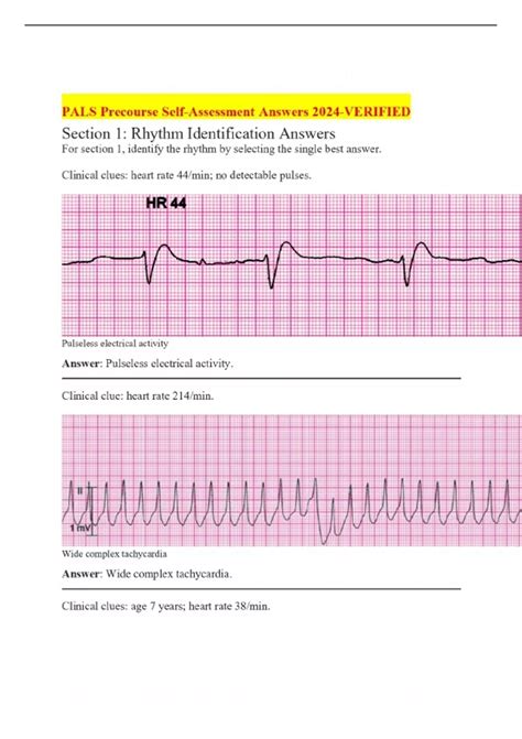 Pals Precourse Self Assessment Answers 2024 Verified Top Rated 2024