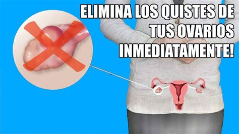 Pin en Feliz día amigas