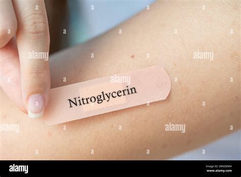 Nitroglycerin Patch Placement
