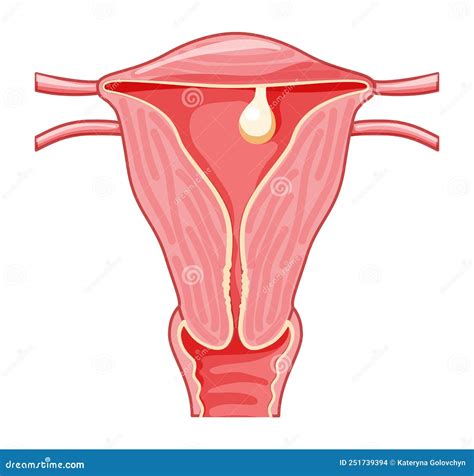 Polyp In The Uterus With Inscriptions Diagram Female Reproductive