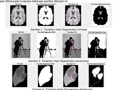 Minimalisasi Distorsi Dari Segmentasi Citra Metode Otsu Menggunakan Fuzzy Clustering