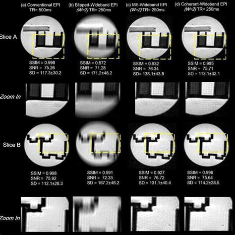 Phantom Results For Multiple Wideband Epi Methods A Standard Epi