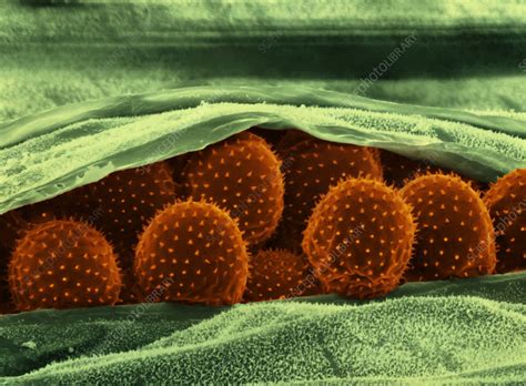 Wheat Leaf Rust Sem Stock Image C022 1113 Science Photo Library