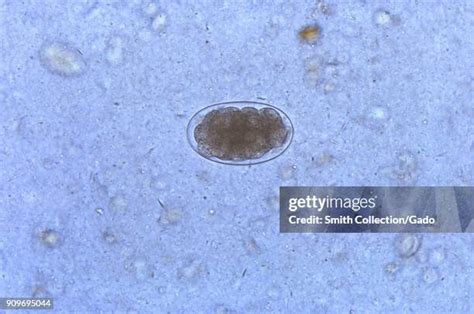 Worm Cell Photos And Premium High Res Pictures Getty Images