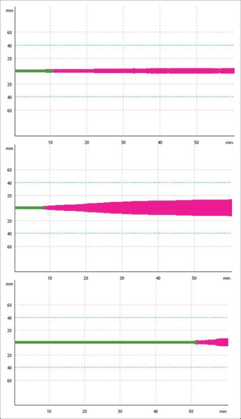 Is Rotational Thromboelastometry The Answer For Rapid Prediction Of Coagulopathy On