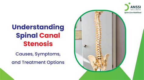 Understanding Spinal Canal Stenosis Causes Symptoms And Treatment