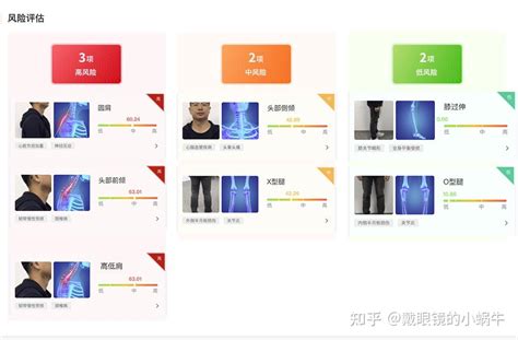 给运动康复师和健身教练推荐一款好用的体态评估工具 知乎