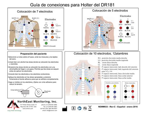¿dónde Se Colocan Los Electrodos Del Electrocardiograma Zpra