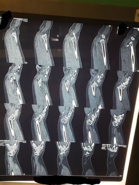 Dr Ahtisham Wafai On Linkedin Guys Kindly Share Your Management