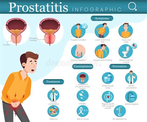 Infographic Of Prostatitis Symptoms Prevention And Treatment