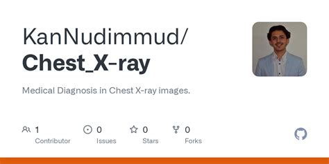 chest x ray chest x ray medical diagnosis with deep learning ipynb at