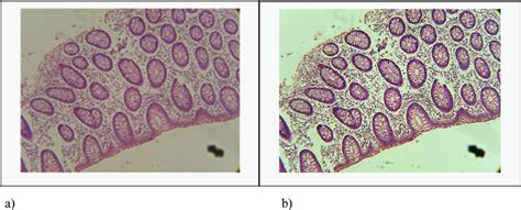 The Equalization Of The Image A Original Image B Equalized Image Download Scientific Diagram