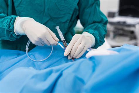 Atherectomy Procedure Near Me