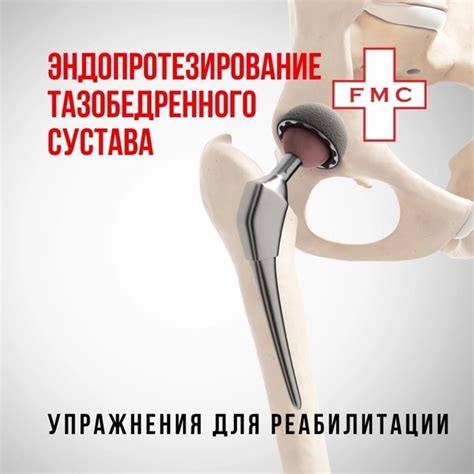 В первые недели после эндопротезирования тазобедренного сустава важно