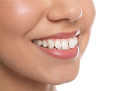How To Fix Gapped Teeth Without Braces