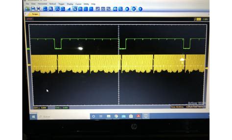 Good Timing Ckp And Cmp Signal Mercedes Gle Class W164 2006 2011 Rotkee