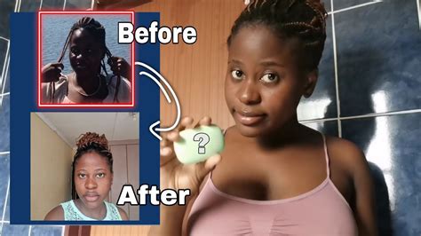The Skincare Routine That BRIGHTENED MY SKIN IN 3 DAYS Natural Way