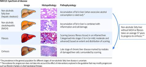 Researchers Have Made A Discovery About How Disease Pathogenesis In The
