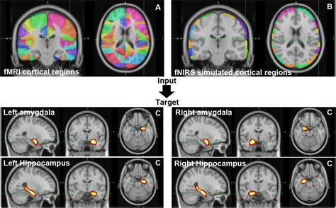 Fmri Amygdala