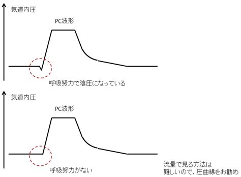 人工呼吸器のモード 自発呼吸の検出（トリガー） ピクトグラムでわかる呼吸器内科