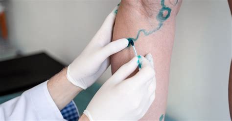 Physical Therapy For Lymphedema To Reduce Swelling Cancer Rehab Pt