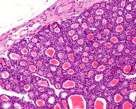 Thyroid Gland Capsule Light Micrograph Stock Image C0545836