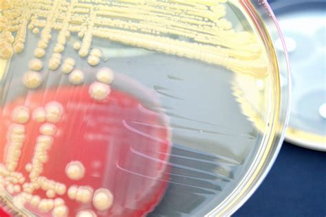 Unlocking The Microbial World Exploring Essential Microbiology