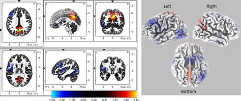 Differences In Estimated Source Activity Between Low And High Angular Download Scientific