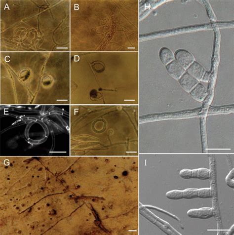 Nematode Trapping Fungi Pmc