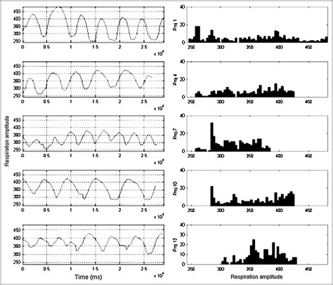 Correction Of Heart Motion Due To Respiration In Clinical Myocardial Perfusion Spect Scans Using