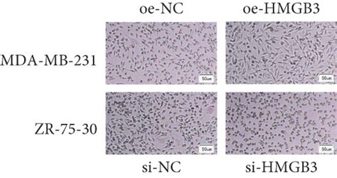 Altered Hmgb3 Expression Affects Bc Cell Proliferation Invasion Download Scientific Diagram