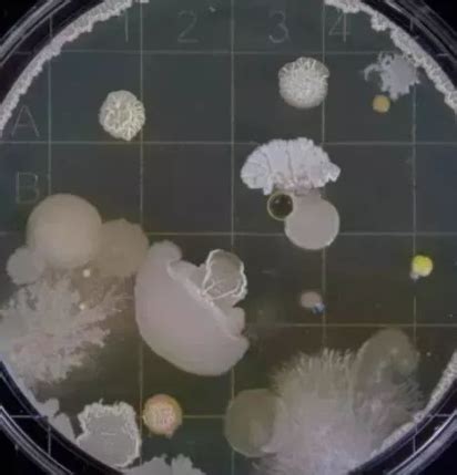微小小单胞菌的菌株培养与实验内容及保存方法！北京百欧博伟生物技术有限公司