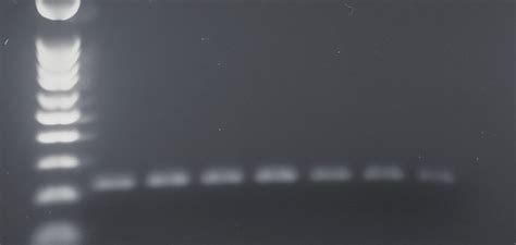 Detection Limits For Single Step And Nested Pcr Pcr Products Were Download Scientific Diagram