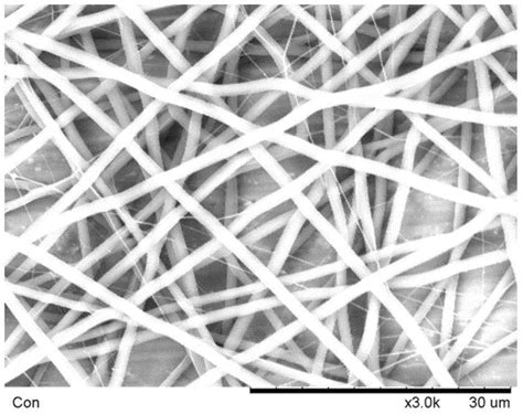 Novel Nanofiber Membrane And Yarn Support For Trachea Transplantation And Method For