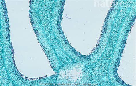 Morchella Under Microscope
