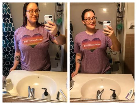 Dressing Comfortably After Breast Reduction Surgery Shunvogue