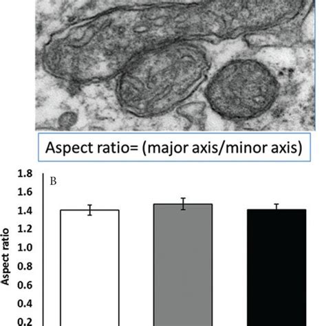 Gingival Mitochondria With A A High Or A Low Aspect Ratio 40000× Download Scientific