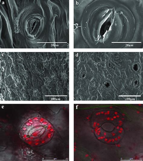 Stomatal Size And Density Of Plants In The Regenerated L Ruthenicum