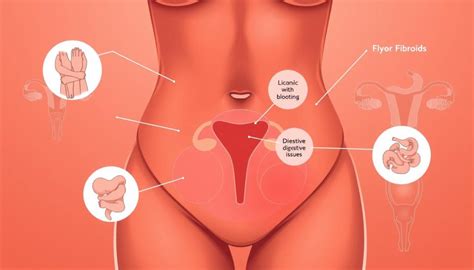 Can Fibroids Cause Digestive Issues Find Out Now