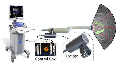 3d Shear Wave Absolute Vibro Elastography System For Targeted Prostate