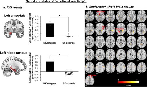 Neural Correlates Of Emotional Reactivity A Neural Activation In Download Scientific Diagram