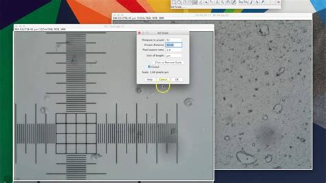 Adding A Scale Bar In Imagej Full Youtube