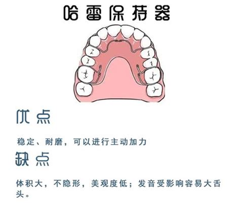 哈雷保持器多少钱一副价格、适用性与选择要点全方面解读 贝色口腔