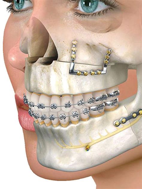 Oral And Maxillofacial Surgery Midac Dental Clinic