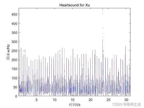 【心电信号ecg】基于matlab小波变换心音信号去噪（二维时域 频域 三维时域 频域）【含matlab源码 4629期】 二维小波变换去噪