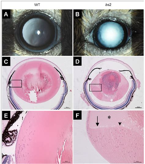 Figure 1 From Blind Sterile 2 Bs2 A Hypomorphic Mutation In Agps