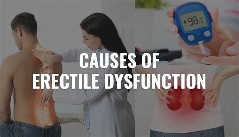 Causes Of Erectile Dysfunction