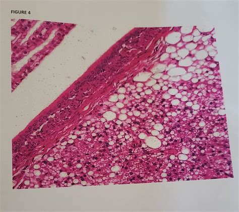 Assignment Unit Name The Four Basic Tissue Chegg